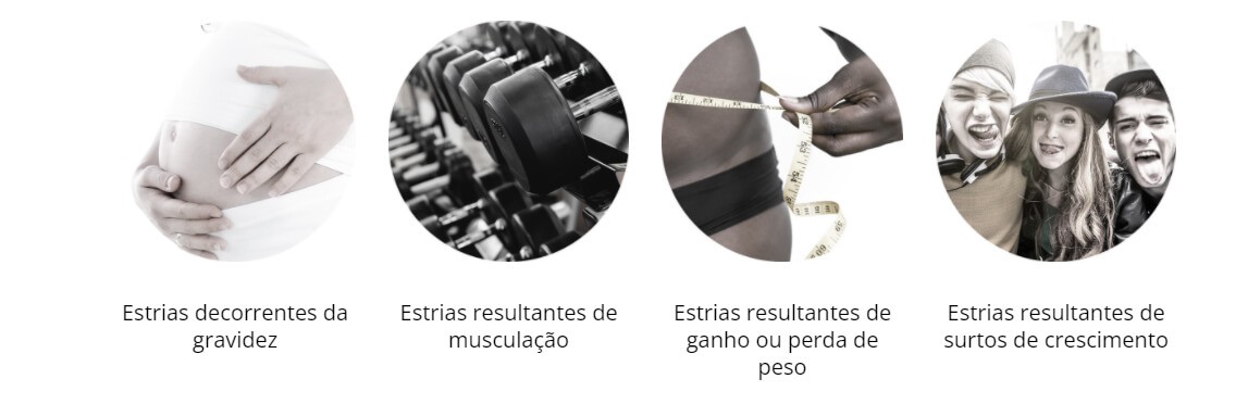 Stratamark Gel Prevenção e Tratamento de Estrias Gravidez Ganho de Peso ...