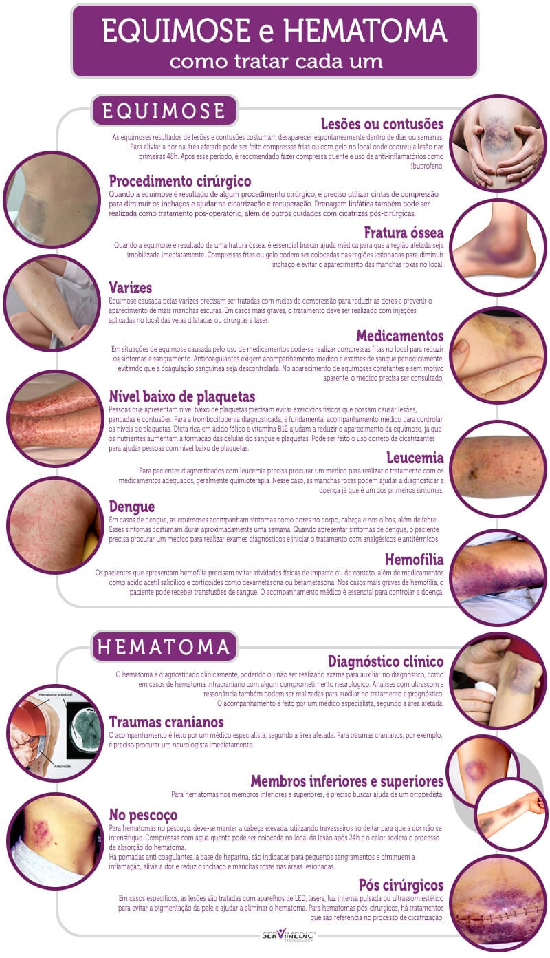 Entenda causas das manchas roxas no corpo e quando é grave - masla.mk